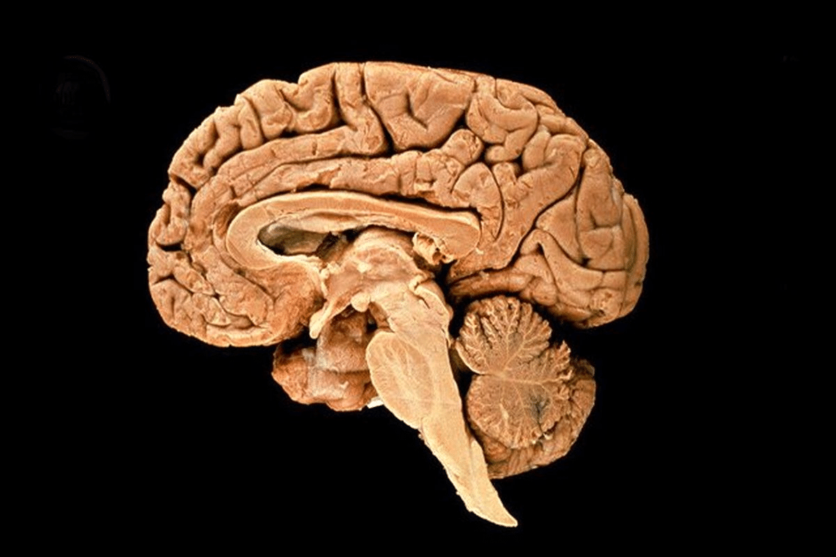 Brain Basics: Best Vital Anatomy Guide - Liv Hospital