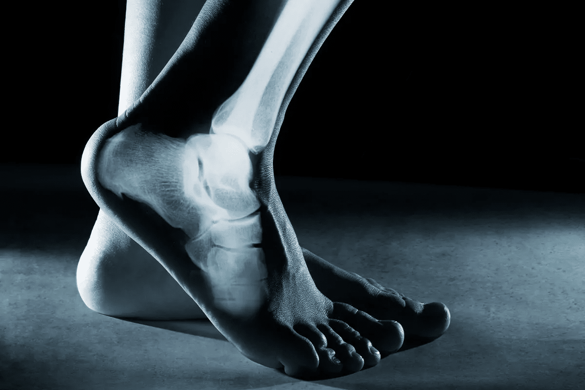 Amazing Arthropathy Definition: Complete Medical Meaning - Liv Hospital