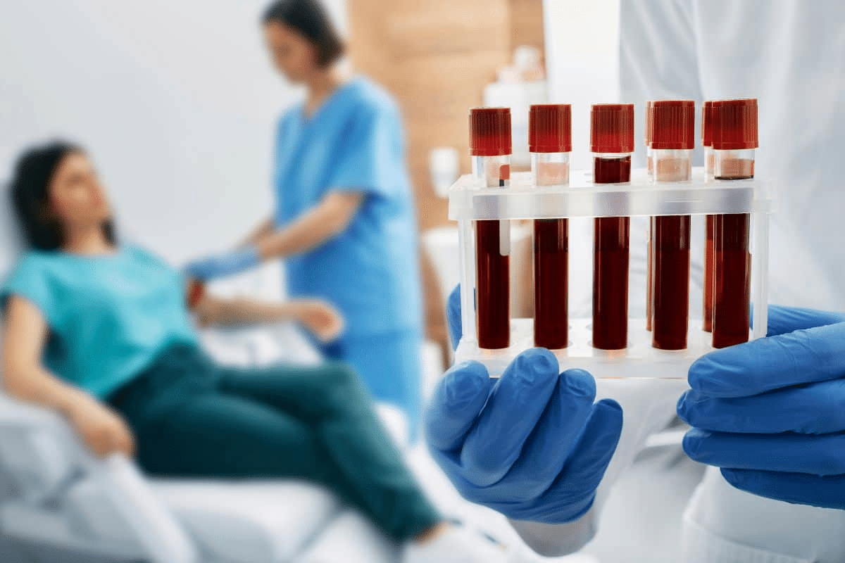 Key Lupus Panel Blood Test: Complete Guide - Liv Hospital