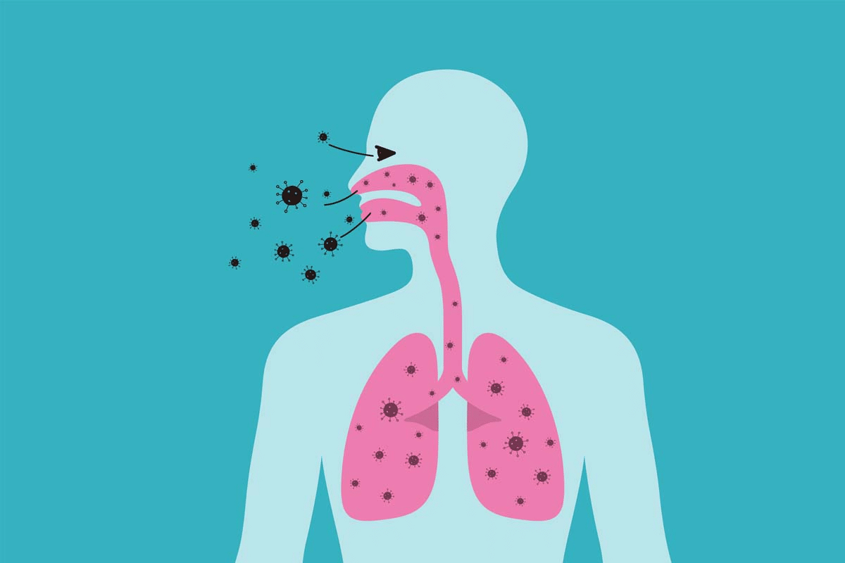 Cold or Bronchitis? Critical Symptoms Guide - Liv Hospital