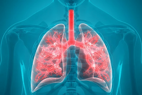 Pneumonia Symptoms: 7 Critical Warning Signs - Liv Hospital