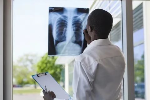 Acute Interstitial Pneumonia: Guide - Liv Hospital