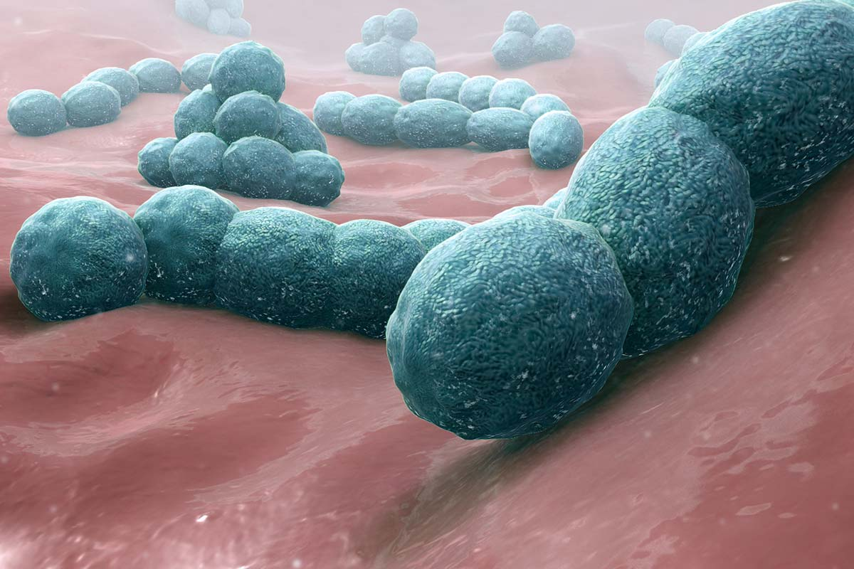 Viral Pneumonia vs Bacterial Pneumonia - Liv Hospital