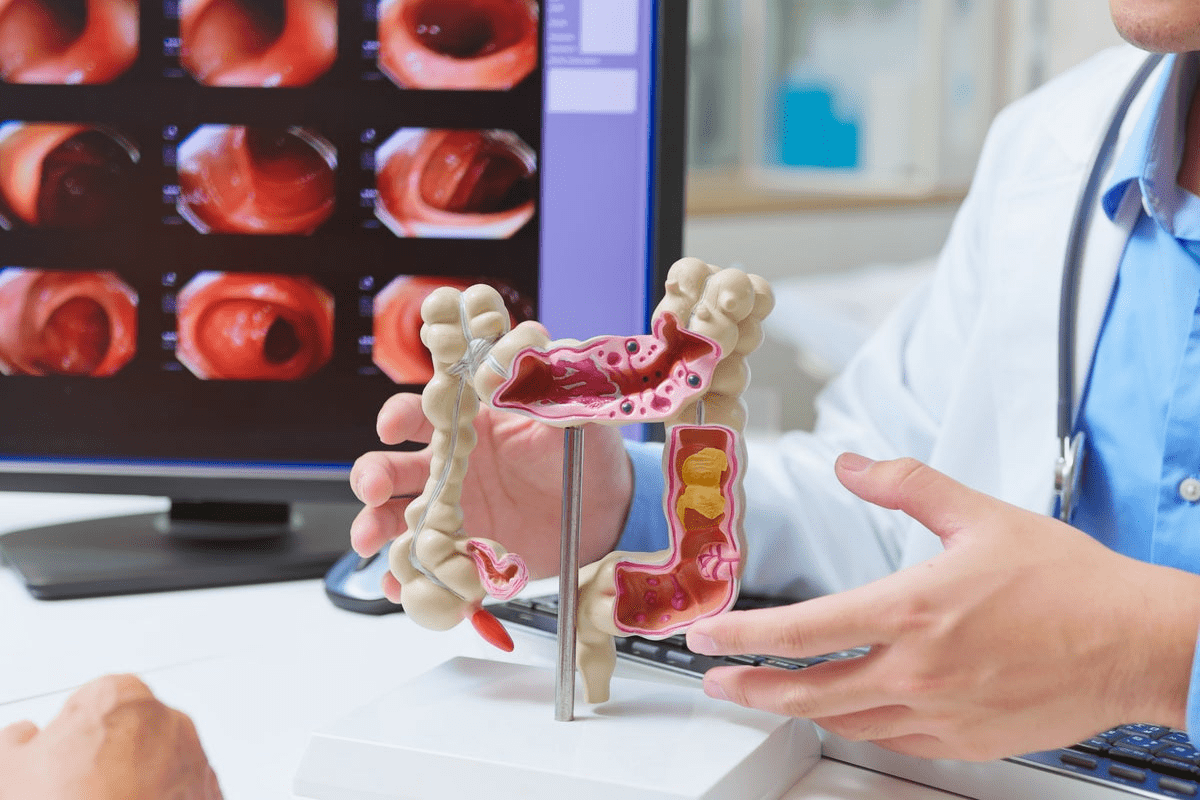 Stool Test Kit: Your Ultimate Guide (5 Best Options) - Liv Hospital