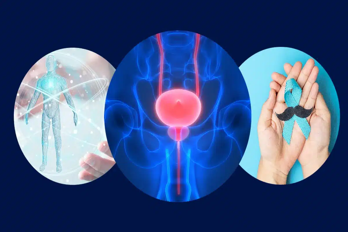 Prostate Cancer: 5 Early Warning Signs - Liv Hospital