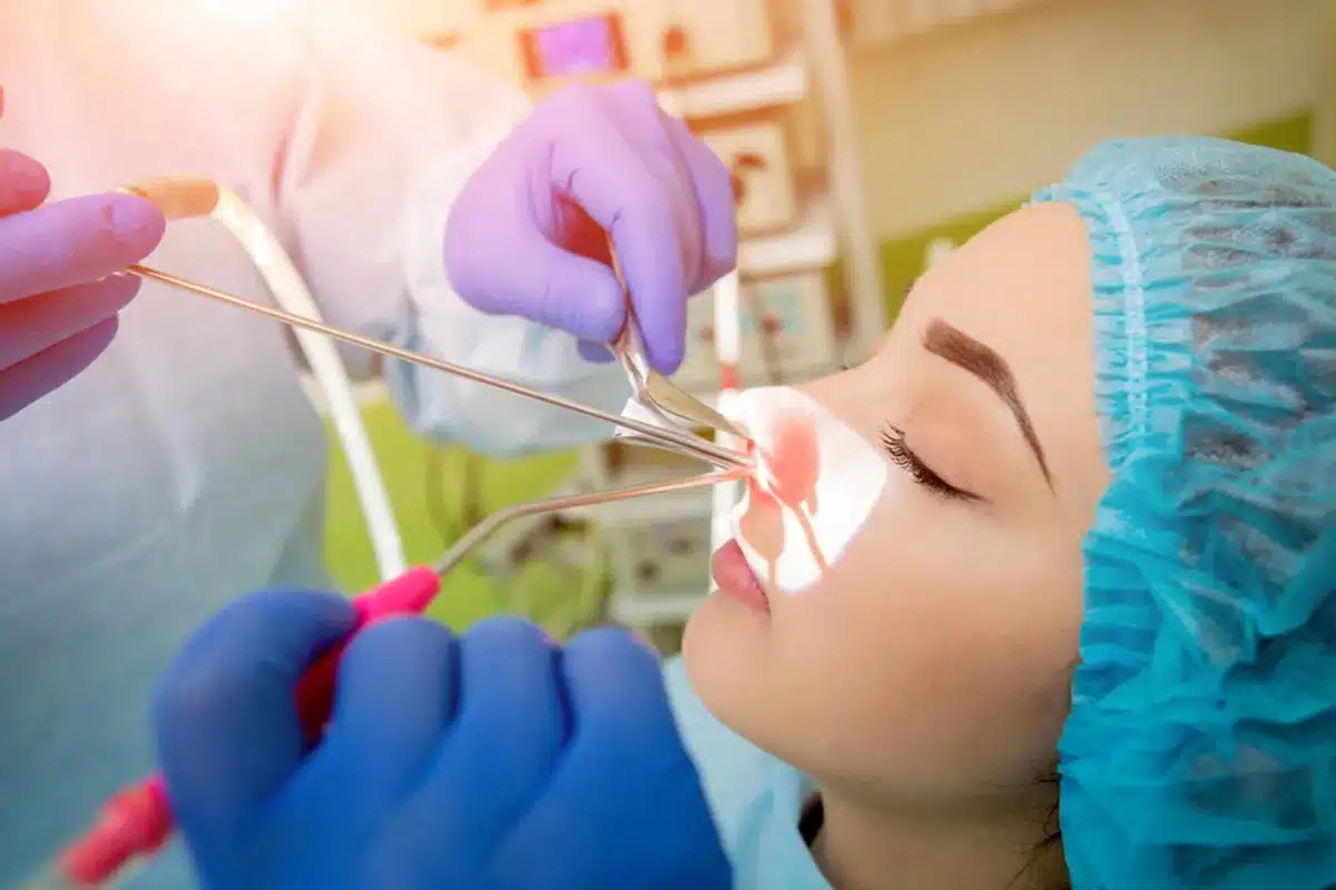 ILESI procedure: The Ultimate Step-by-Step Guide - Liv Hospital