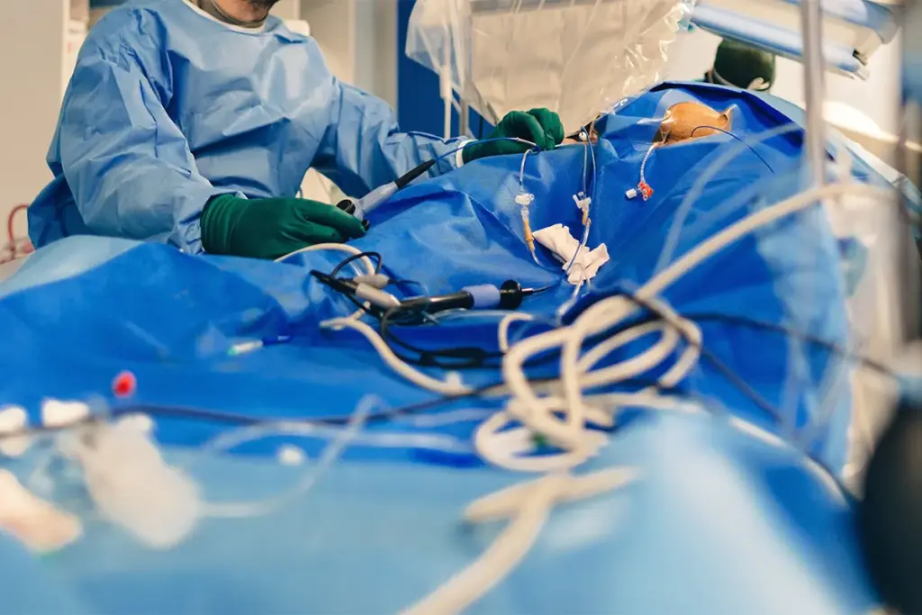 Cath Lab Procedures: Best Safe Walk Tips - Liv Hospital