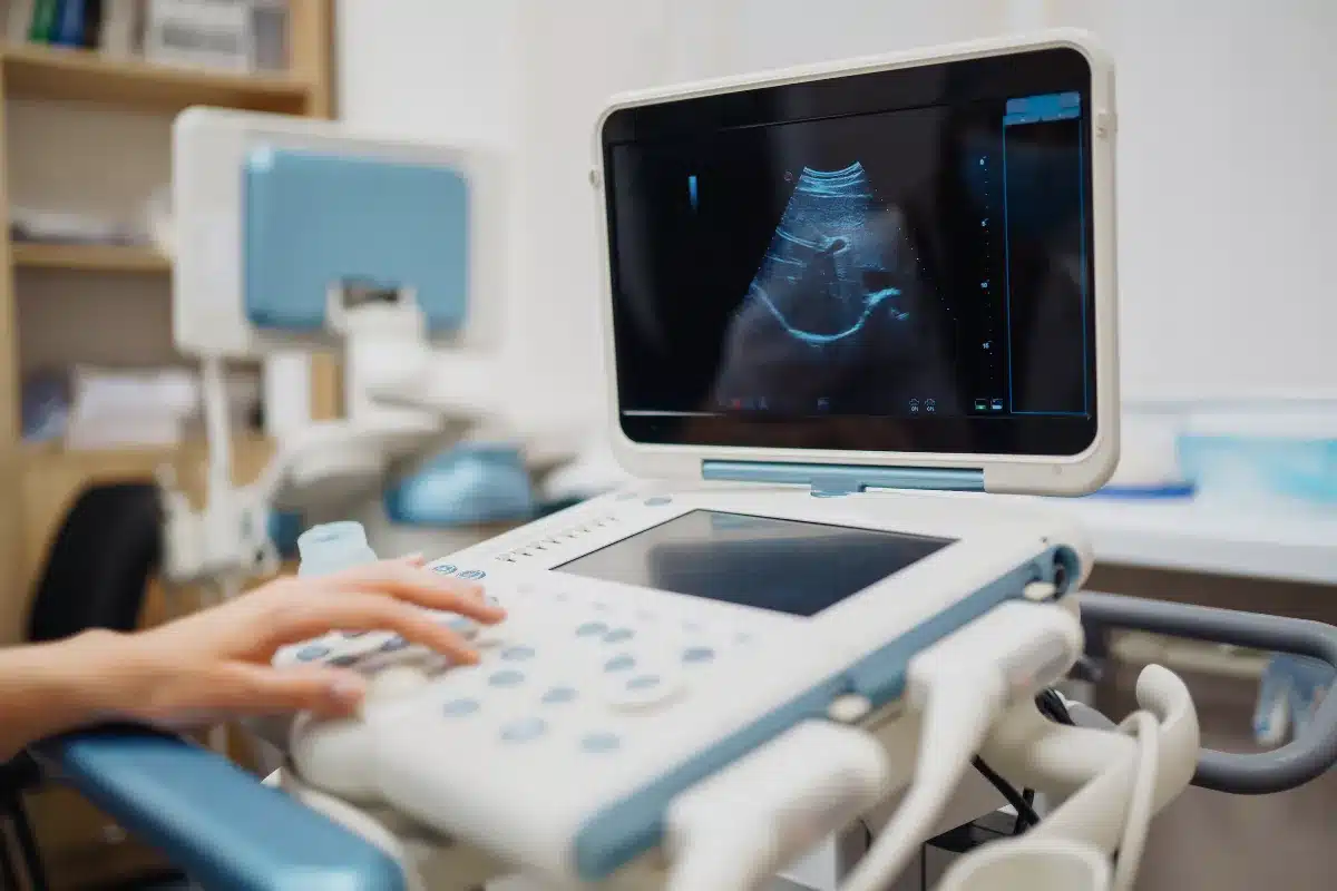 Vascular Ultrasound: Best Doctor Tips - Liv Hospital
